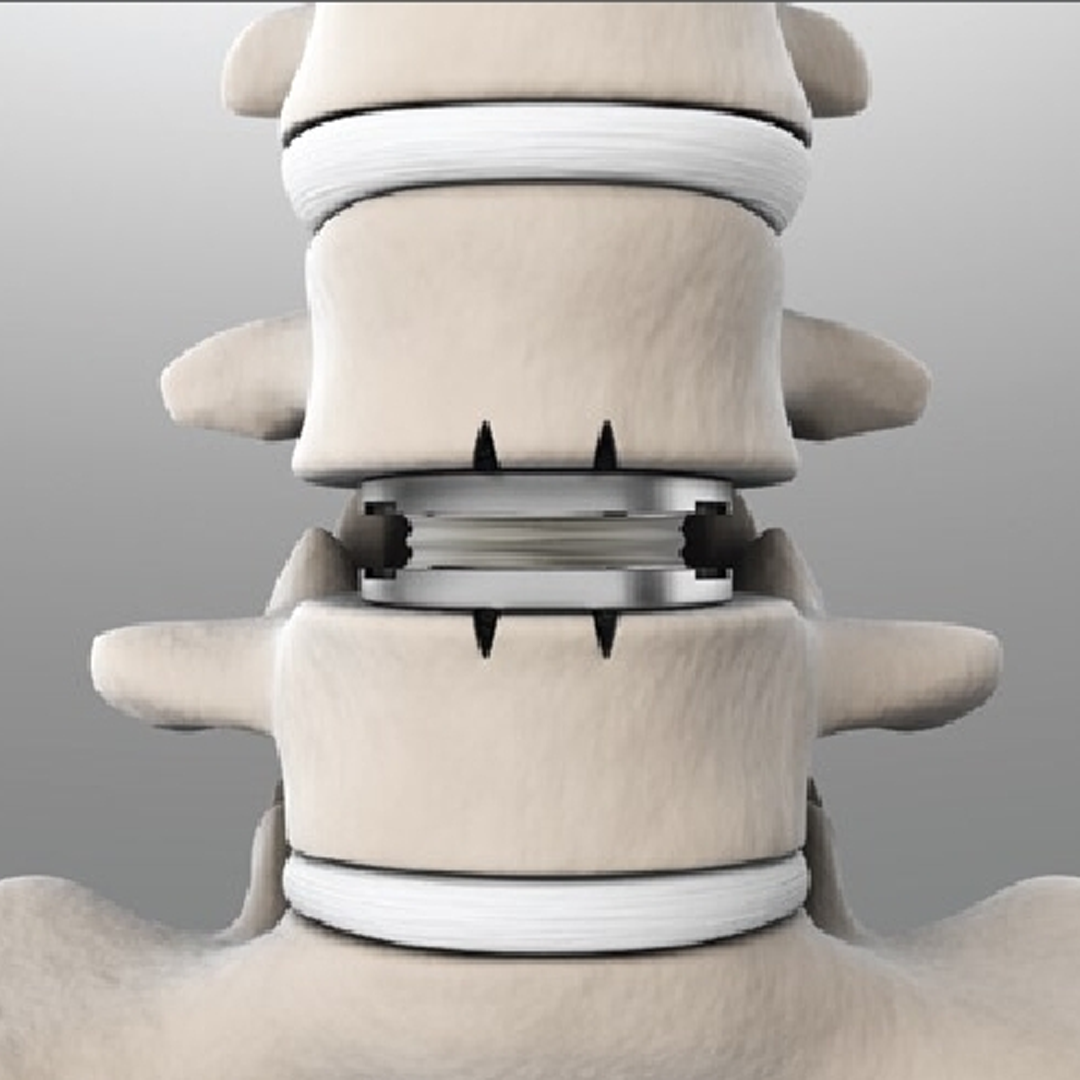 Dr Amit Jain - Ortho Spine and Physio Rehab Center